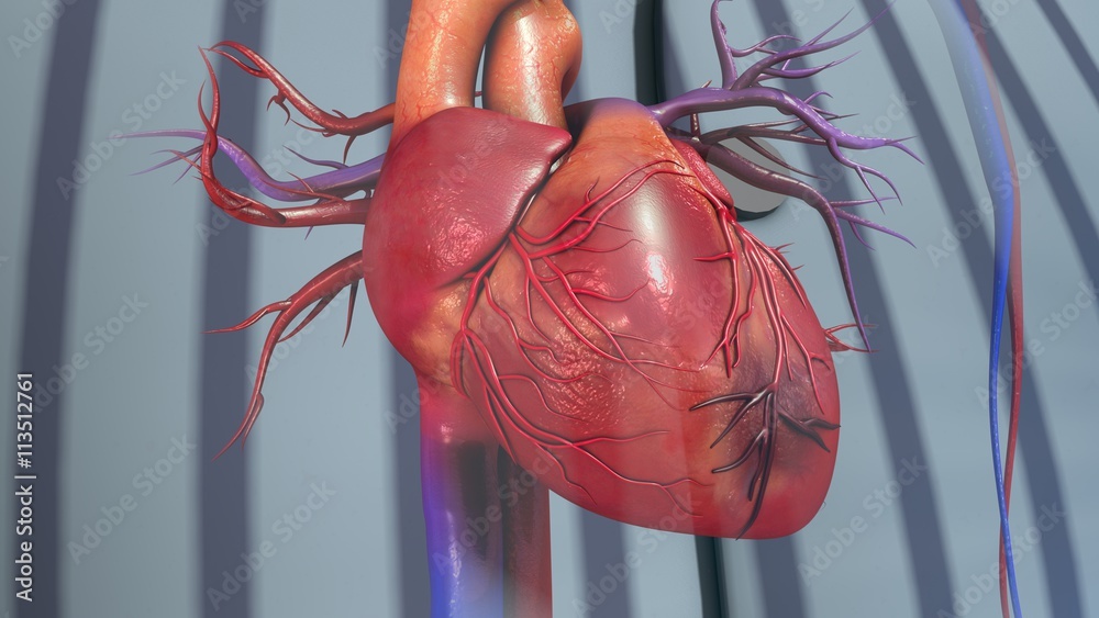 Myocardial Infarction Stock Illustration | Adobe Stock