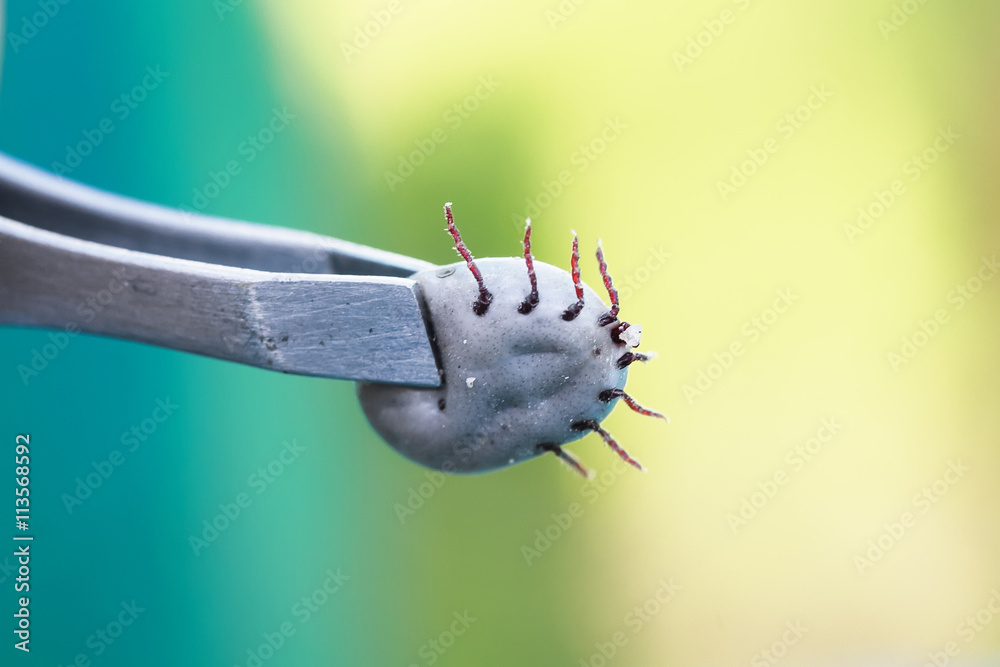 inflated with blood the tick is pulled out metal tongs Stock Photo ...