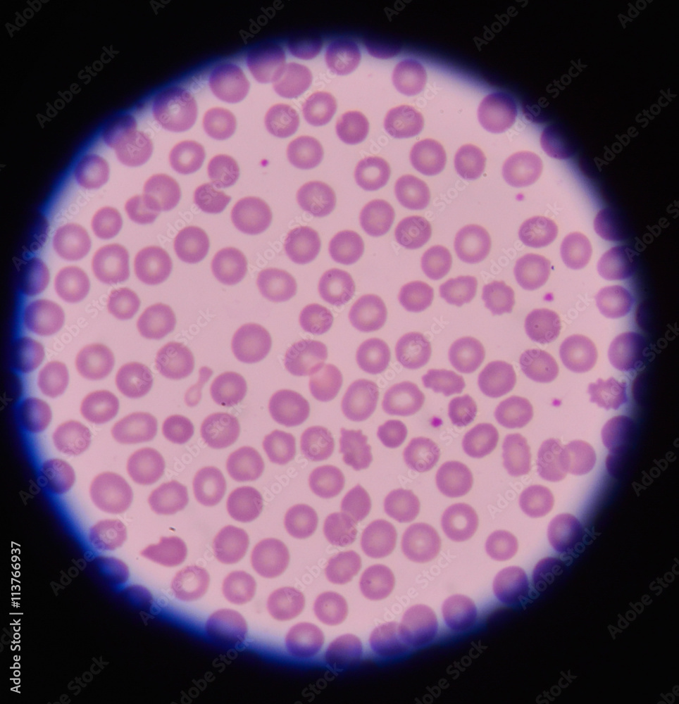 Blood test for Complete Blood Count. CBC Stock Photo | Adobe Stock