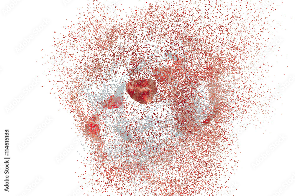 Destruction of a tumor cell. 3D illustration. Series of images showing ...