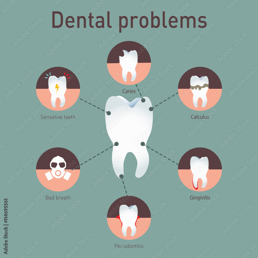 Medical vector infografics Dental problems. Stock Vector | Adobe Stock