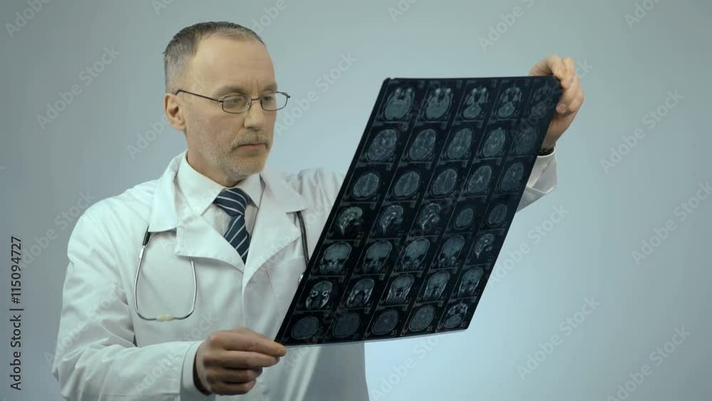 Doctor looking at MRI brain scan, satisfied with patient's positive ...
