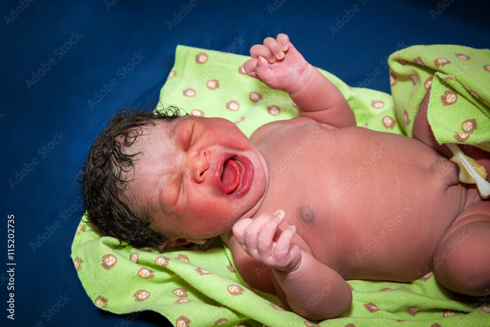 Crying Newborn Cut Umbilical Cord Stock Photo | Adobe Stock