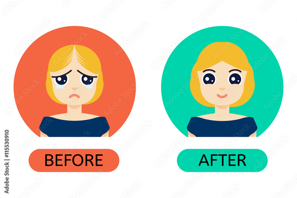 Woman with hair loss problem before and after hair treatment and hair ...
