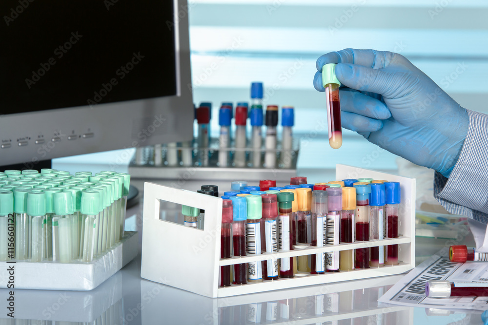 scientist with a tube of blood in front of a computer screen / hand ...