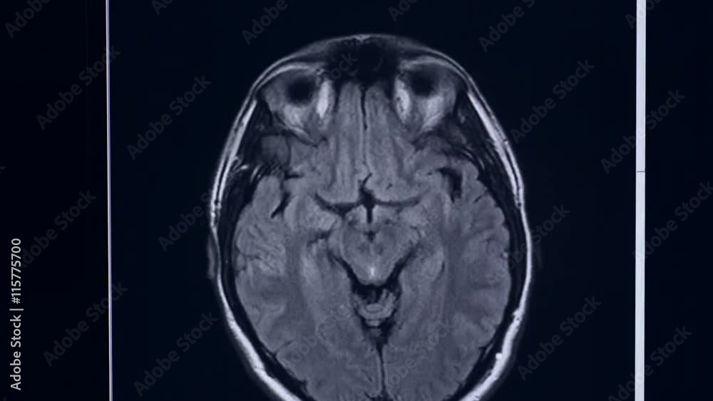 MRI brain scan, side view, top view, back view Stock Video | Adobe Stock