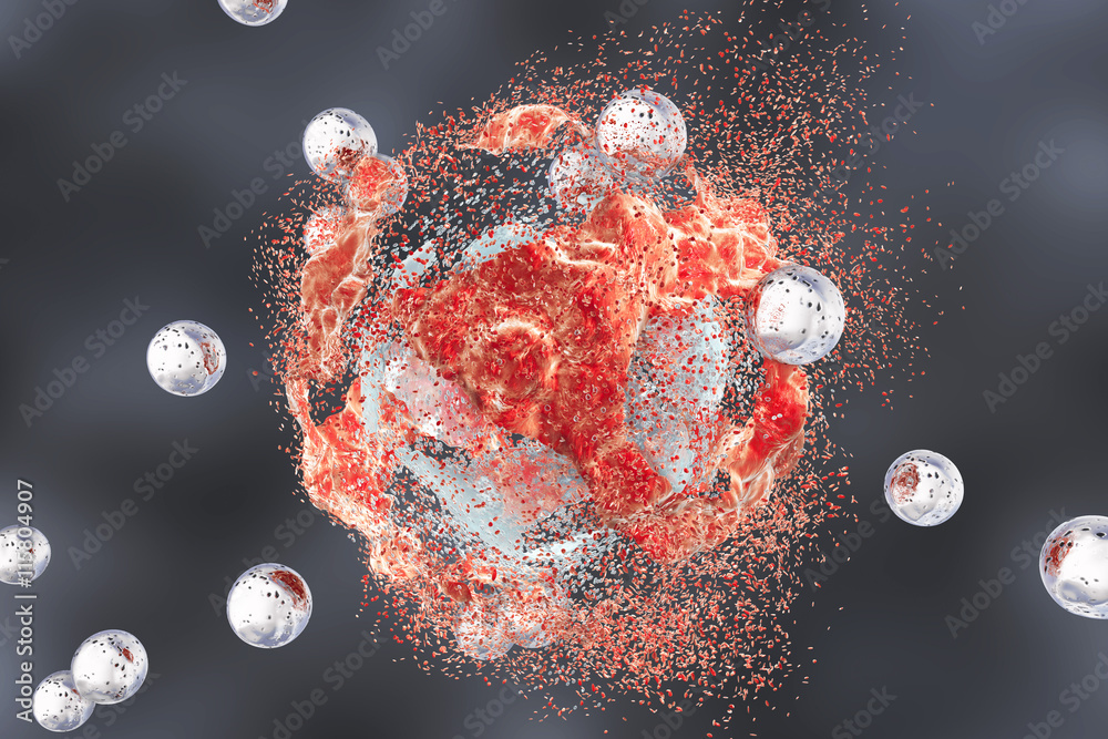 Destruction of a tumor cell by nanoparticles. 3D illustration. Can be ...