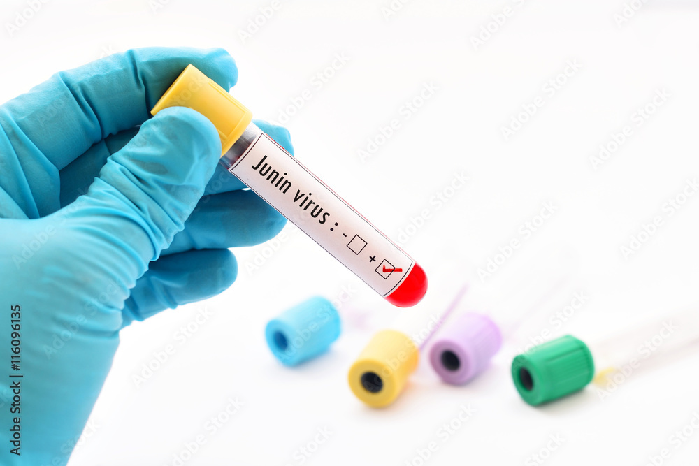 Blood sample positive with Junin virus Stock Photo | Adobe Stock