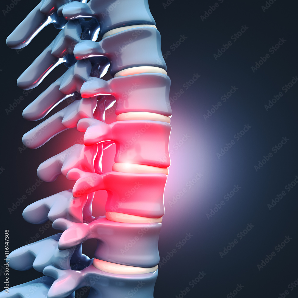 3d image of a blue spine with red areas indicating health problems ...