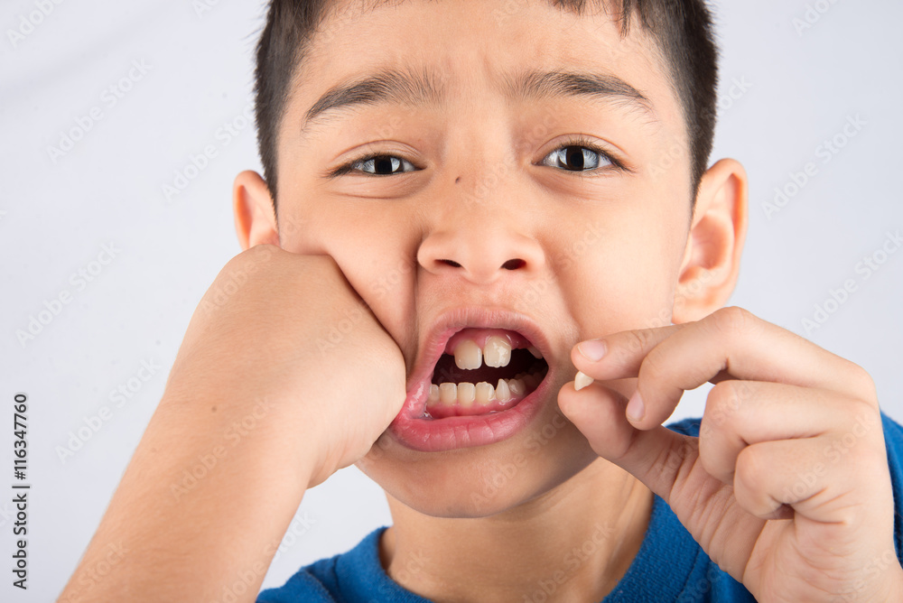 Little boy showing baby teeth toothless close up waiting for new teeth ...