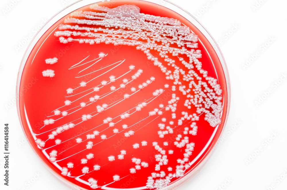 Bacterial culture growth on Blood agar media (Staphylococcus aur Stock ...