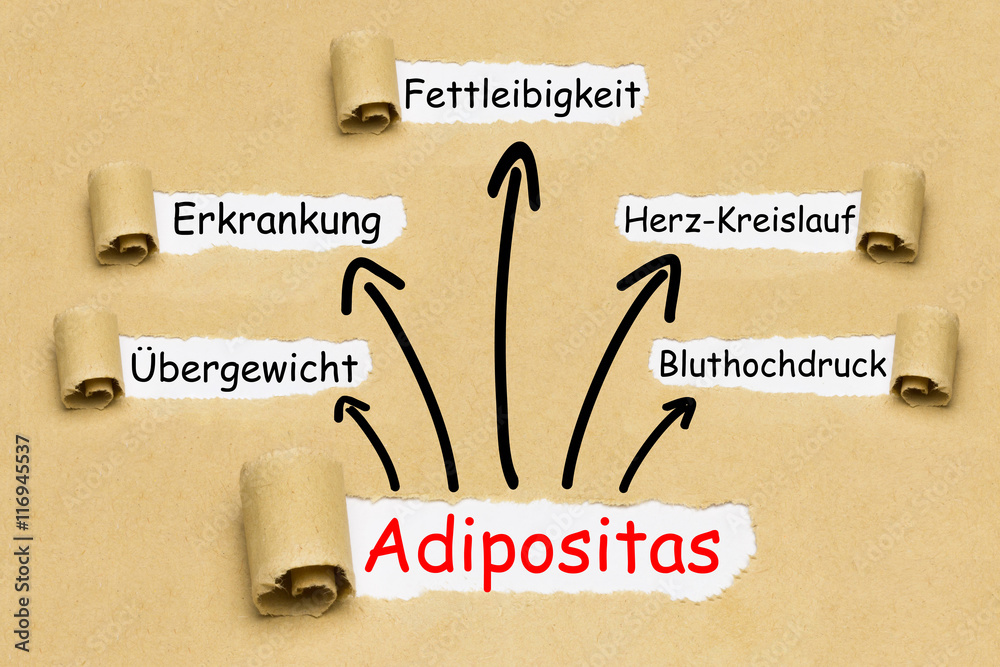 Adipositas Stock-Foto | Adobe Stock