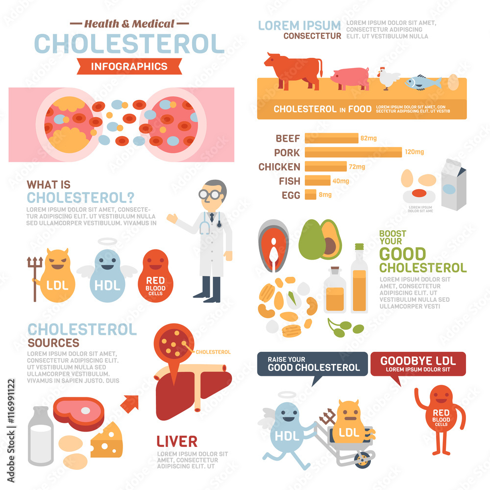 Cholesterol Infographics Stock Vector | Adobe Stock