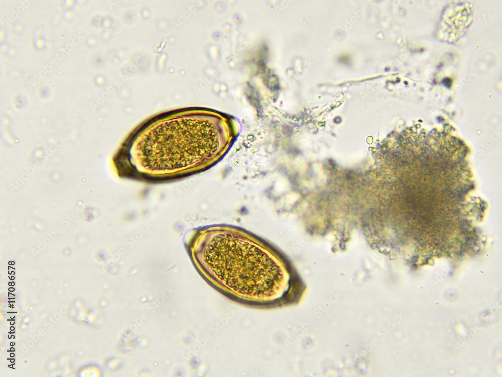 Trichuris Trichiura Egg