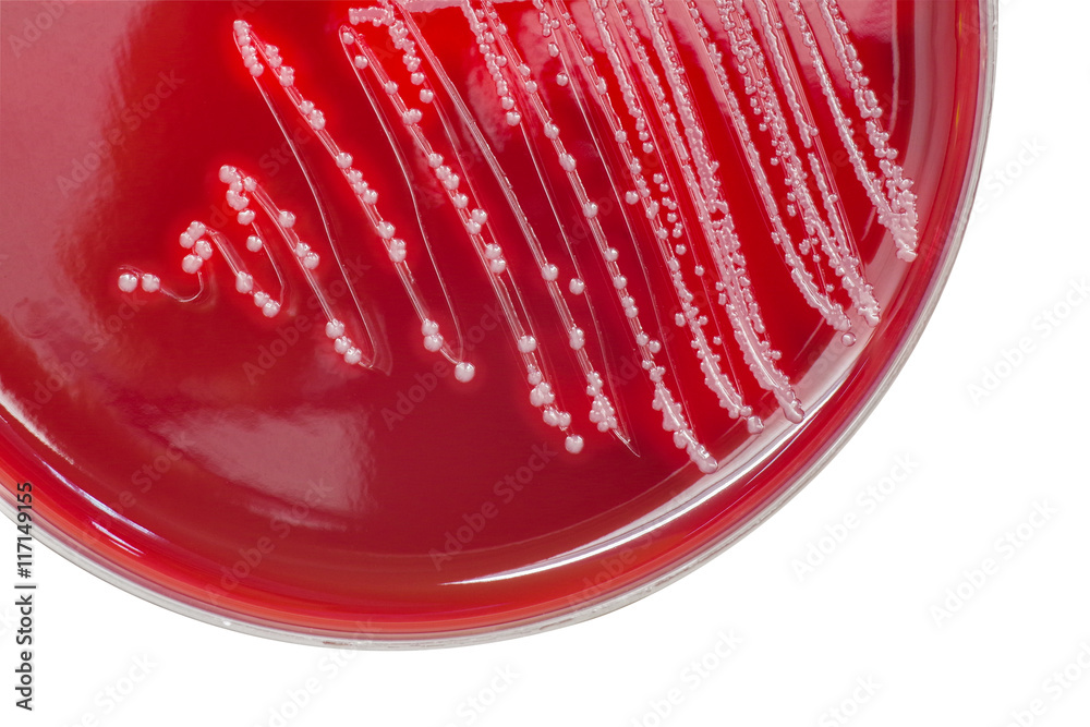 Poster Streptococcus bacterial colonies with beta hemolytic on blood ...