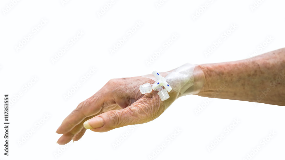 Three way connector for intravenous infusion inserted on hand of ...