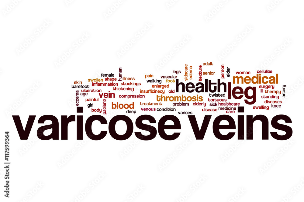 Varicose veins word cloud concept Stock Illustration | Adobe Stock