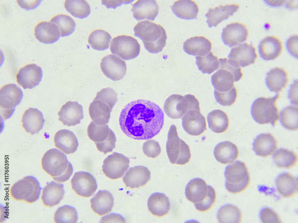 White blood cell in peripheral blood smear, Wright stain #117603951 ...