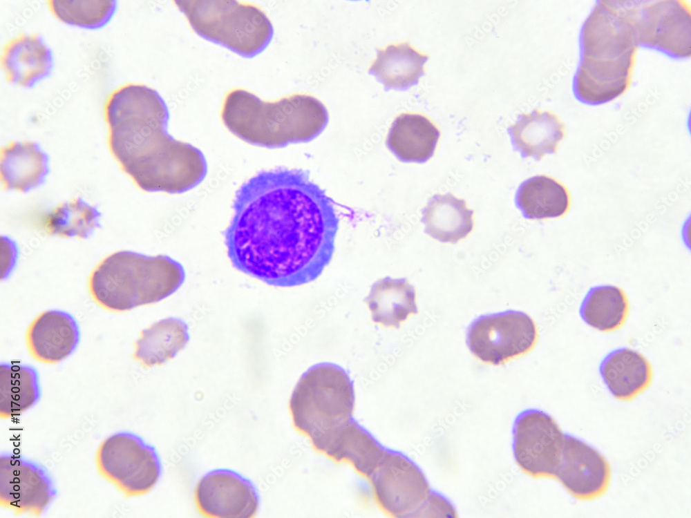White blood cell in blood smear Stock Photo | Adobe Stock