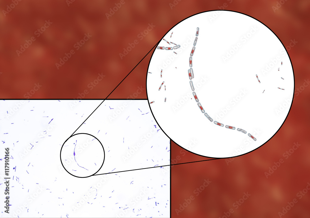 Bacillus anthracis, light micrograph and 3D illustration, gram-positive ...