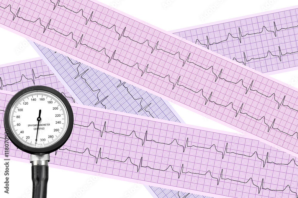 Stethoscope on cardiogram sheet of cardiology patient. Cardiolog Stock ...