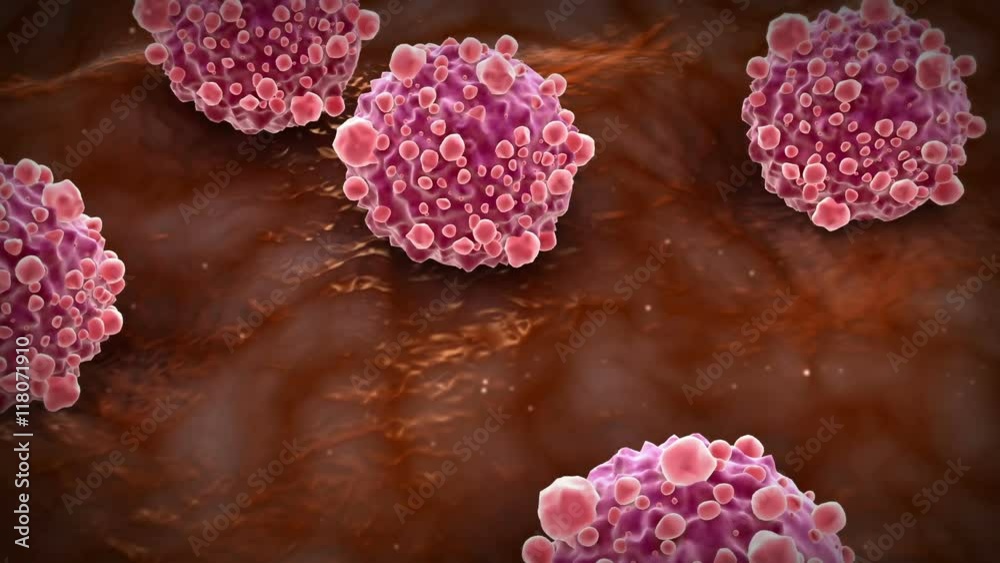 Microscopic visualization of pancreatic cancer cells. Stock Video ... Microscopic visualization of pancreatic cancer cells. Stock Video ...