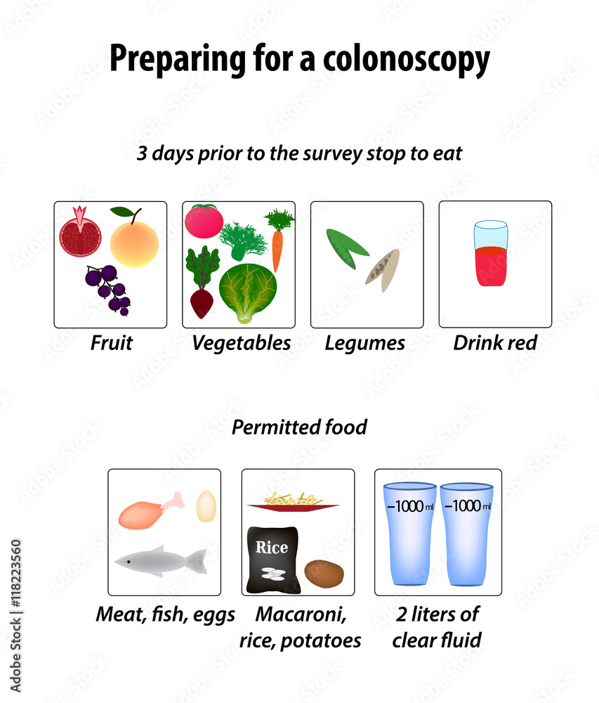 Preparing for a colonoscopy. Diet for Colonoscopy. Vector illustration ...