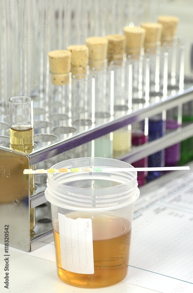 Urinprobe im Labor mit Urinteststreifen Stock-Foto | Adobe Stock