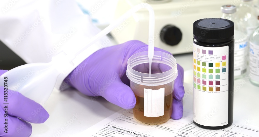 Doping und Drogentest mit Urinprobe im Labor mit Urinteststreife Stock ...