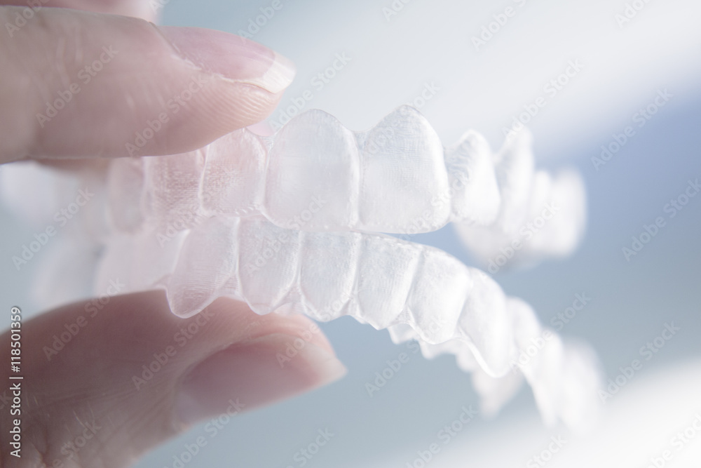 Invisible dental teeth brackets tooth aligners plastic braces Stock ...