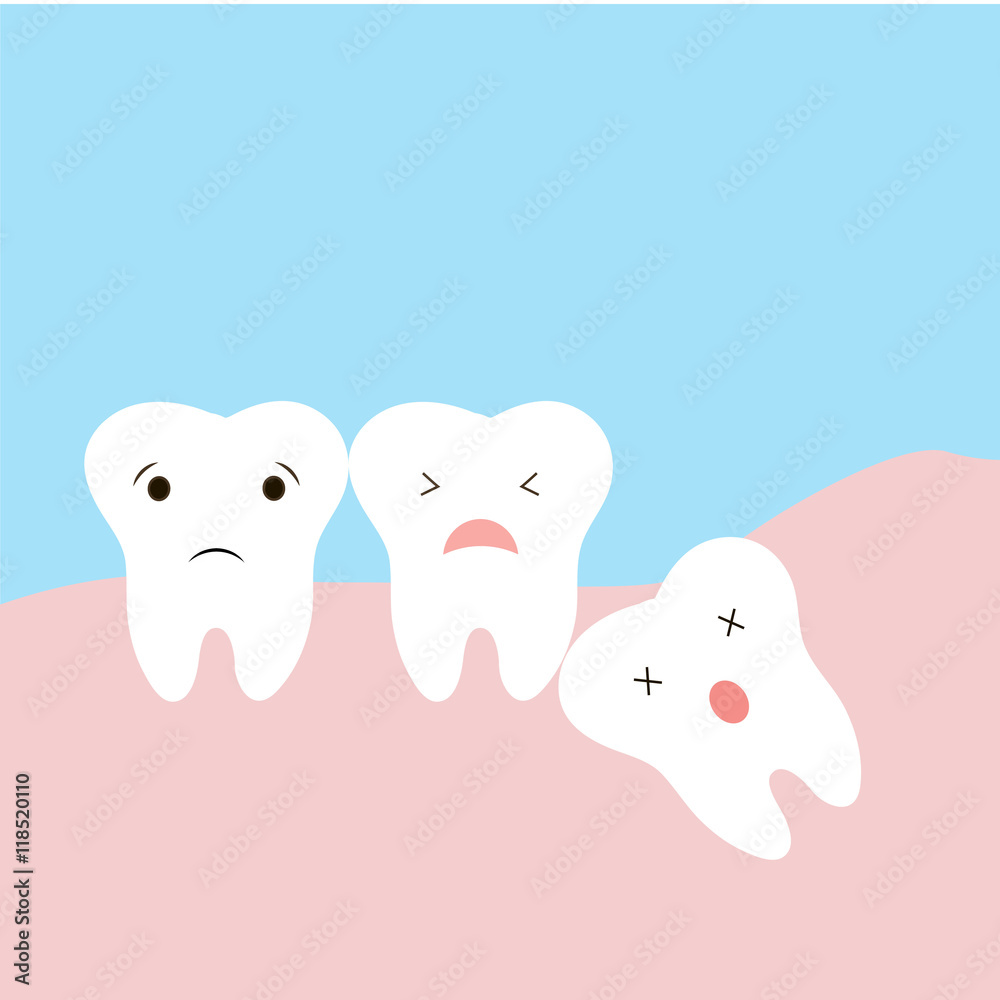 Problems caused by impacted wisdom teeth include. Sleepy tooth of ...
