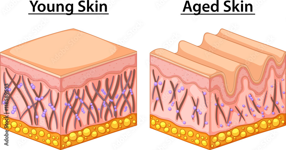 Diagram showing young and aged skin Stock Vector | Adobe Stock