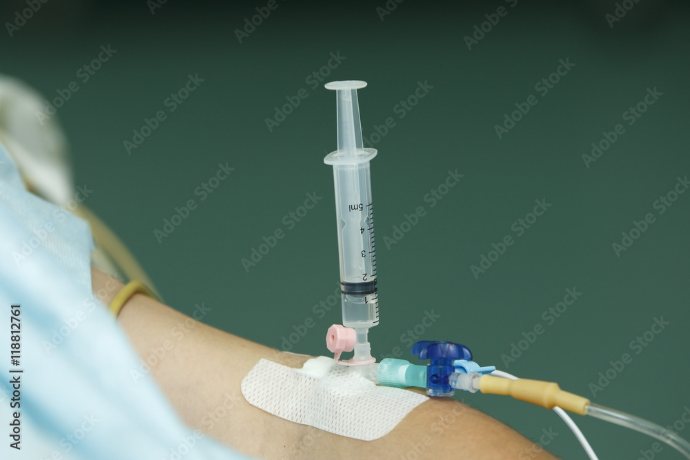 5 ml syringe with a drug inserted into catheter in patients hand close ...