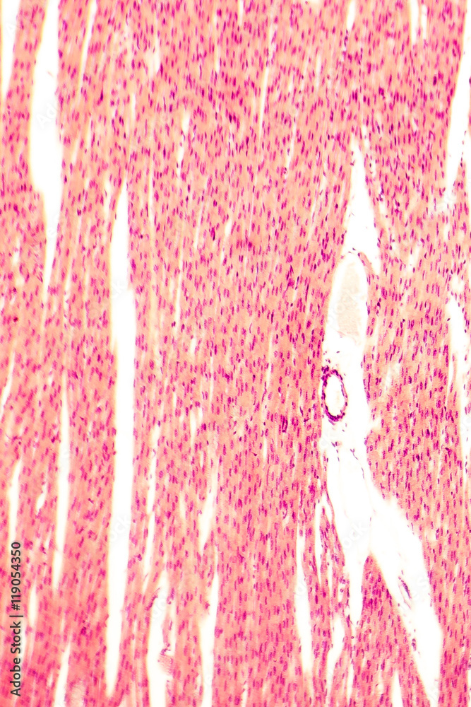 Heart muscle, light micrograph. Striated cardiac muscle cells (myocytes ...
