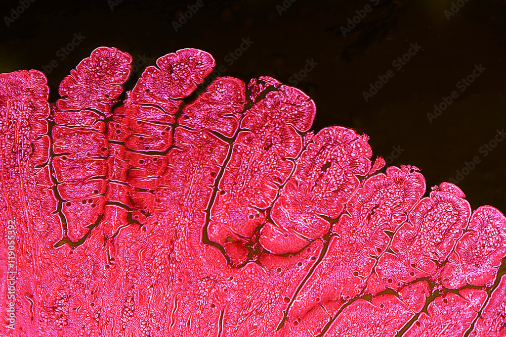 Villi of small intestine, light micrograph with enhanced colors to ...
