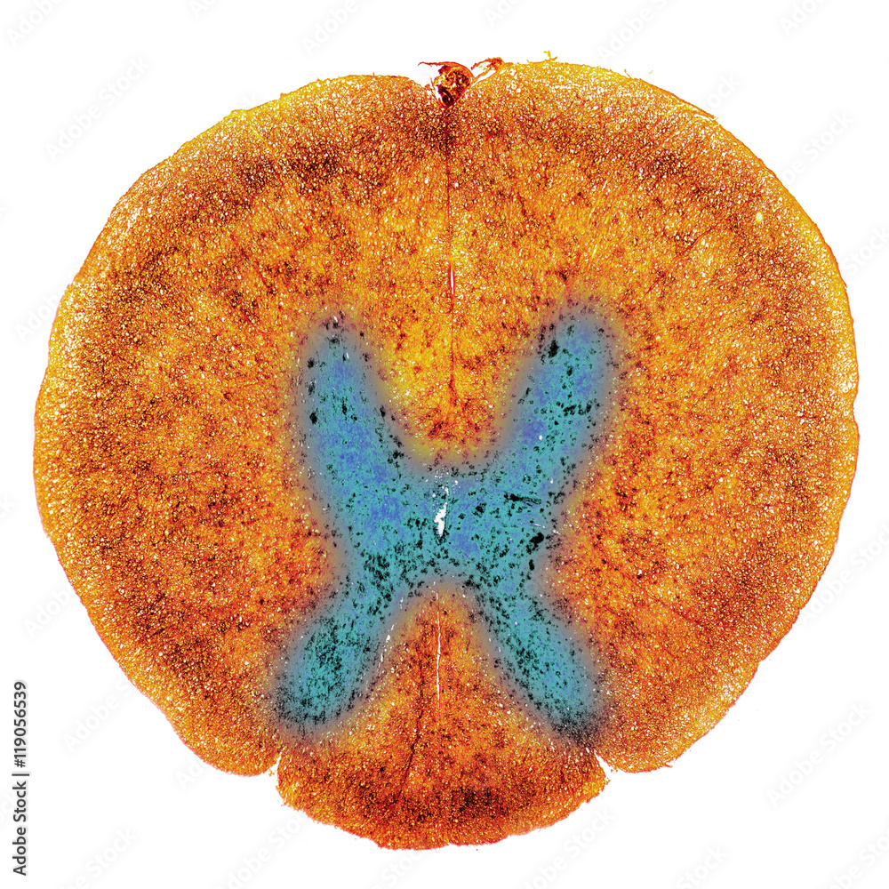 Spinal cord, cross-section. Light micrograph which shows the white ...