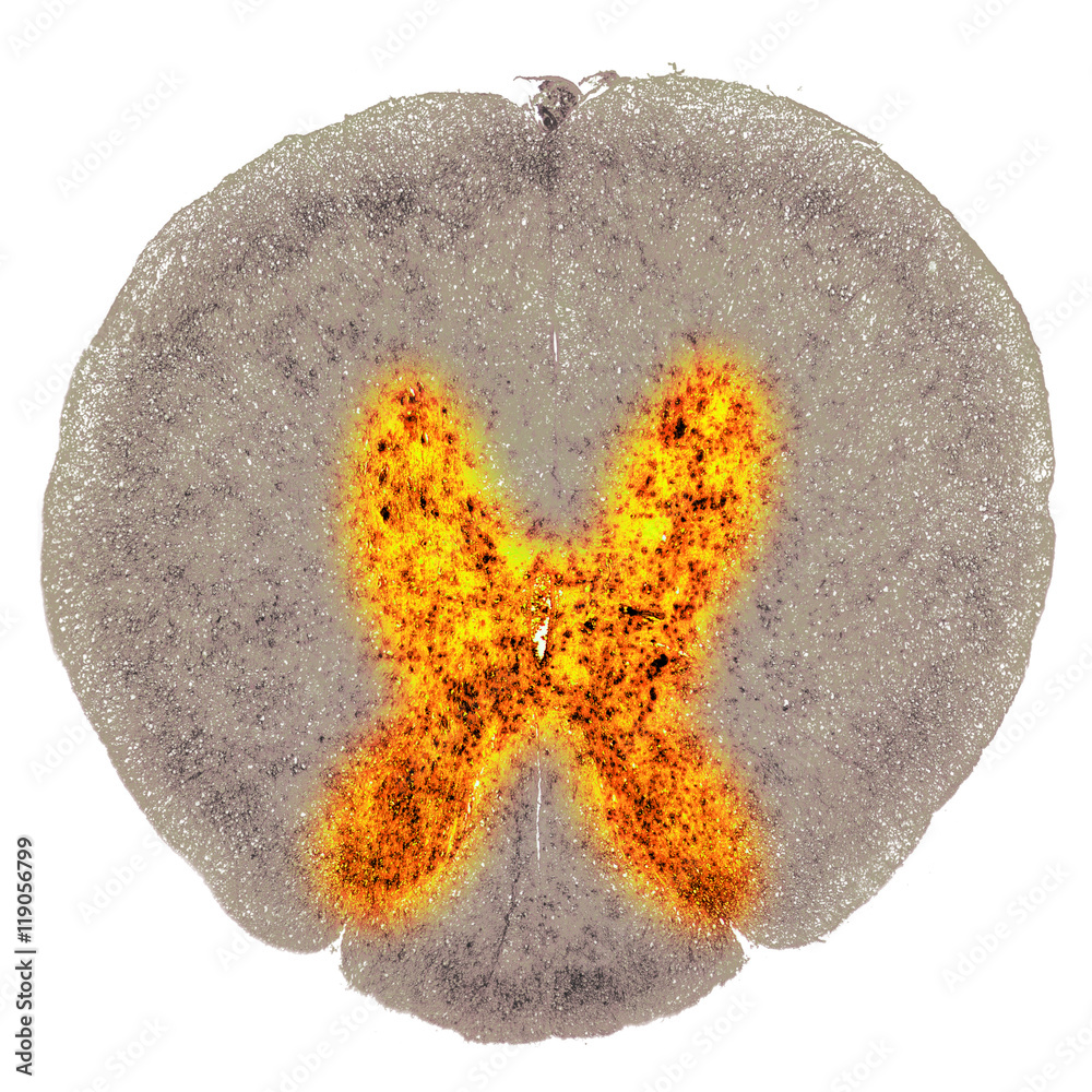 Spinal cord, cross-section. Light micrograph which shows the white and ...