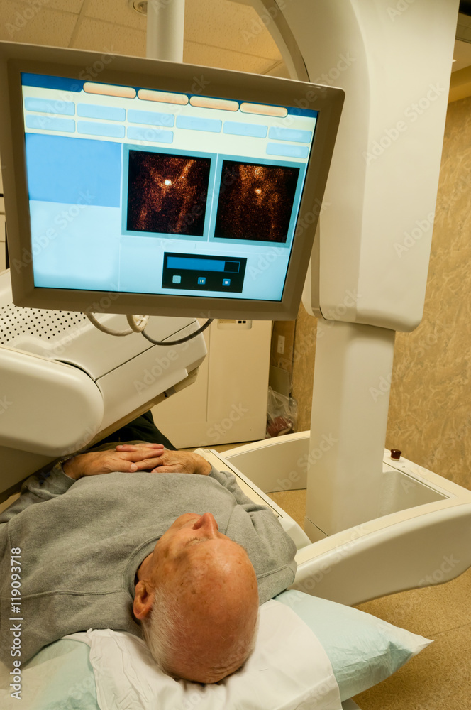 Gamma Camera Bone Scan of Elderly Male Patient Lying Down. Vertical ...