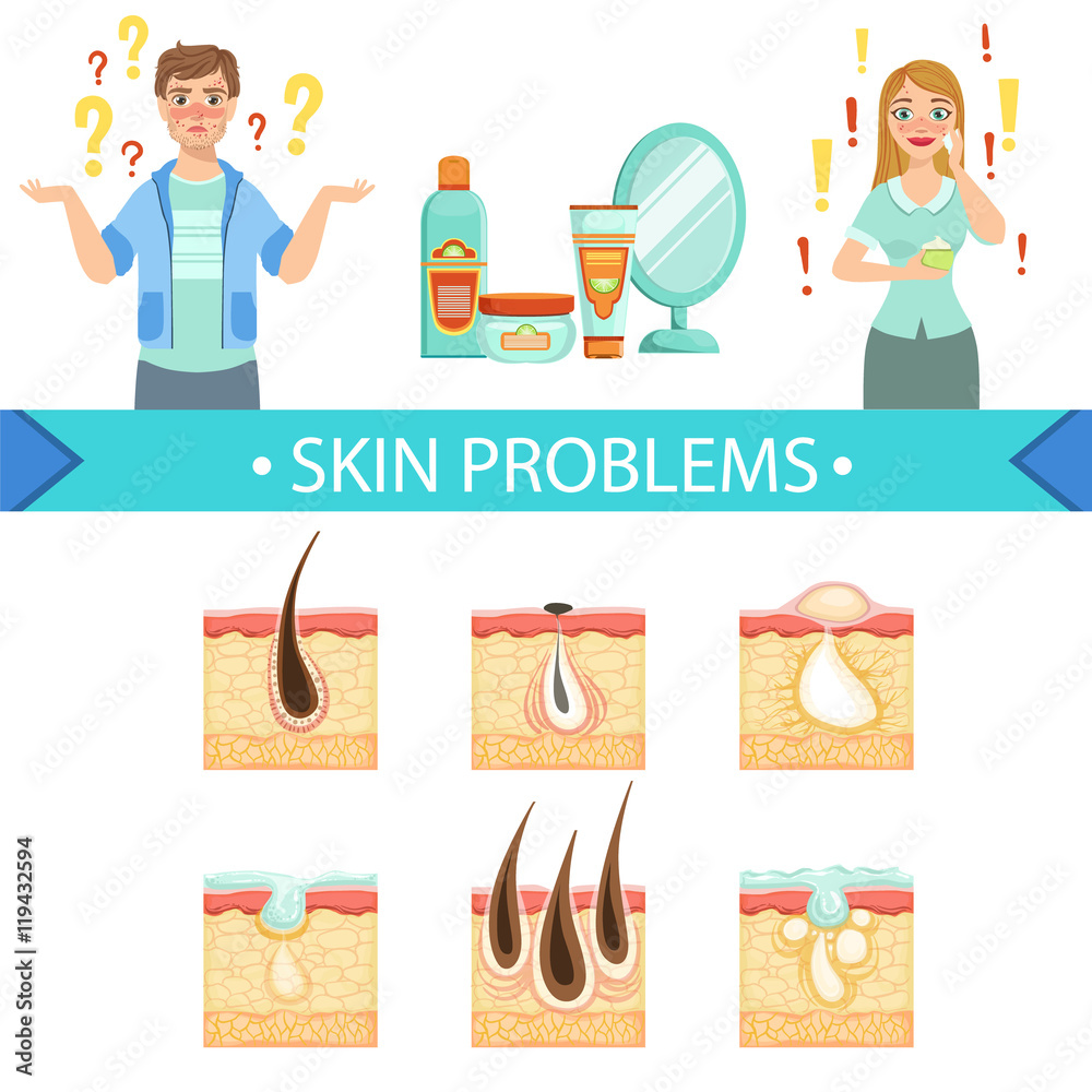 Skin Problems Infographic Medical Poster Stock Vector | Adobe Stock