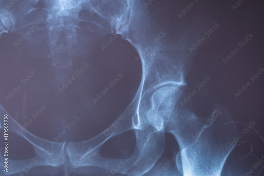 X-Ray image of human for a medical diagnosis Stock Photo | Adobe Stock