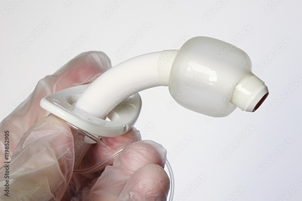 Tracheostomy tube with inflated cuff held in left hand in glove. Stock ...