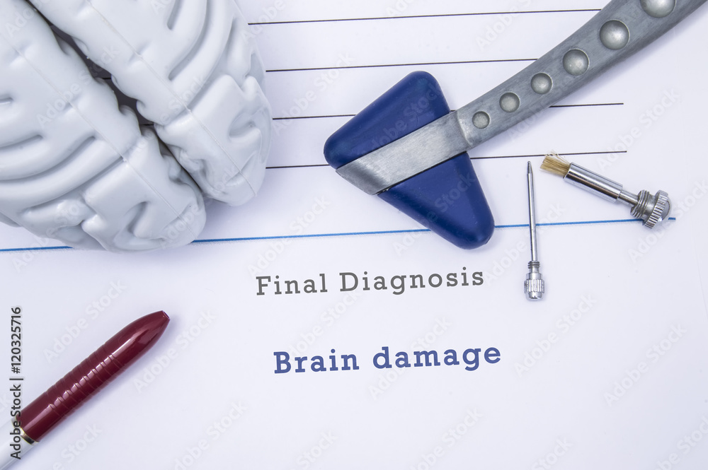 Printed medical form with diagnosis Brain damage with the figure of the ...