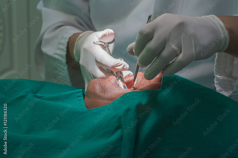 Dentistry, anesthetic injection, dentists are to be tooth extraction ...