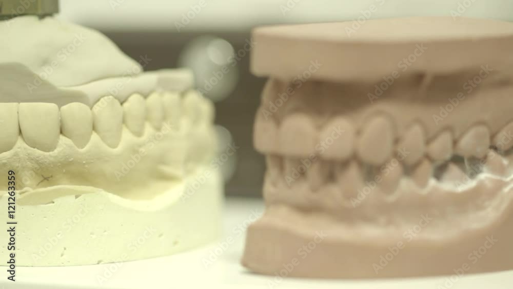 Camera pans between two types of teeth mould. (Filmed in ProRes with ...