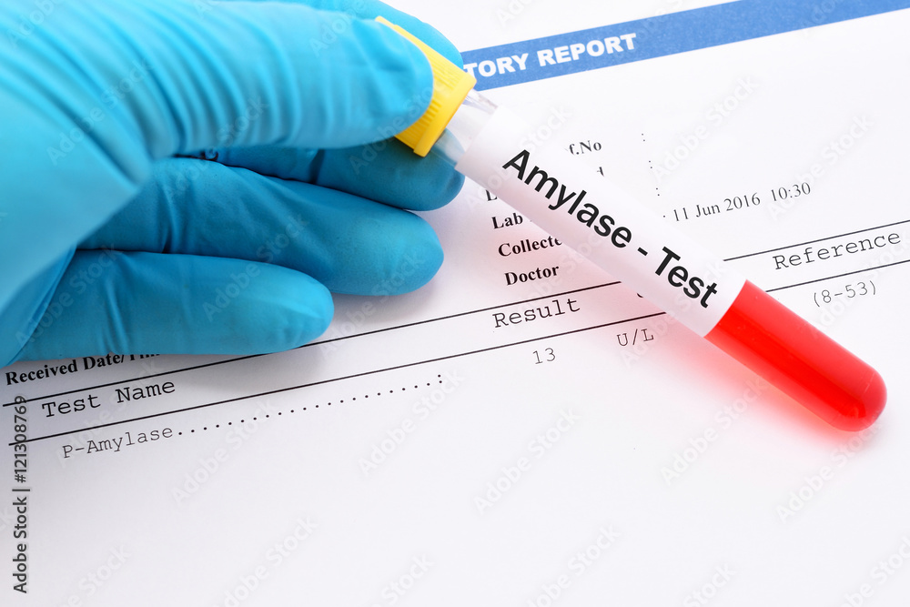 Blood sample for amylase enzyme test with result Stock Photo | Adobe Stock