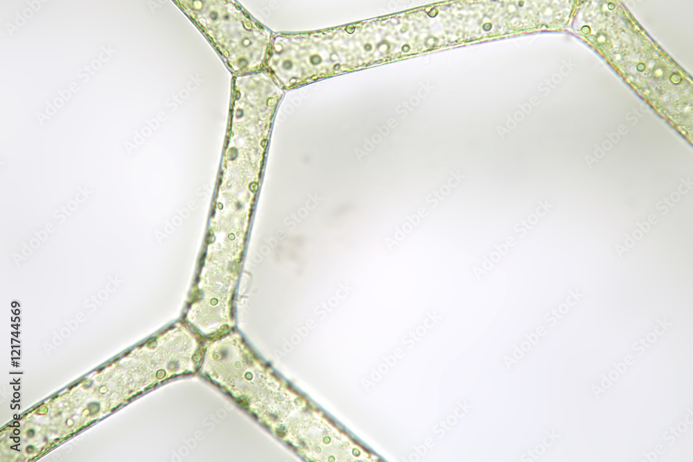 Honeycomb algae Hydrodictyon reticulatum. Super macro. Aquaculture ...