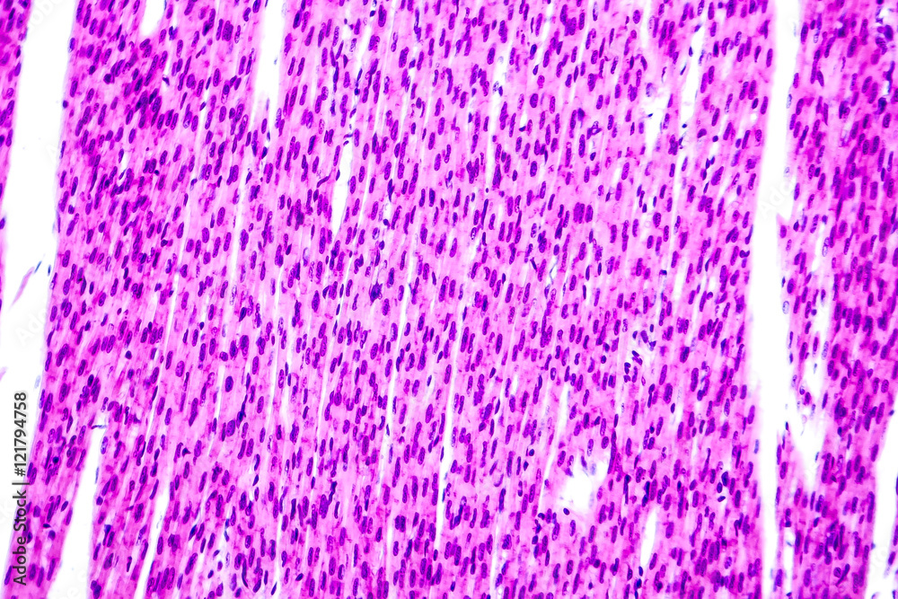 Foto de Heart muscle, light micrograph. Striated cardiac muscle cells ...
