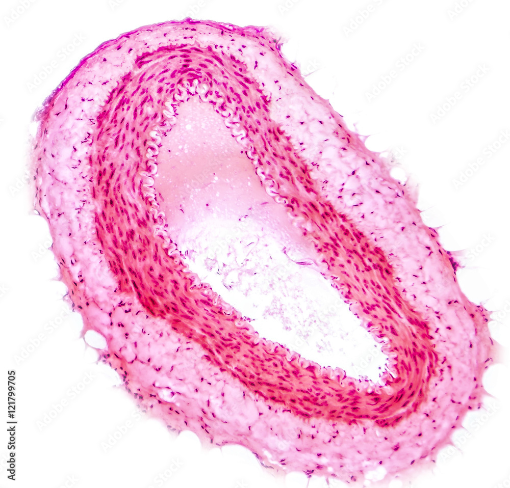 Light micrograph of a muscular artery. Artery has thicker wall than ...