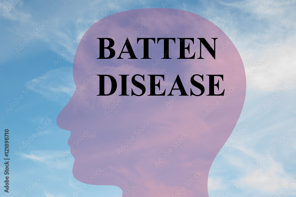 Batten Disease - neural concept Stock Illustration | Adobe Stock
