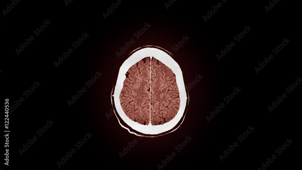 Human brain MRI scan. Top view. Smooth motion, brown tint. vídeo do ...